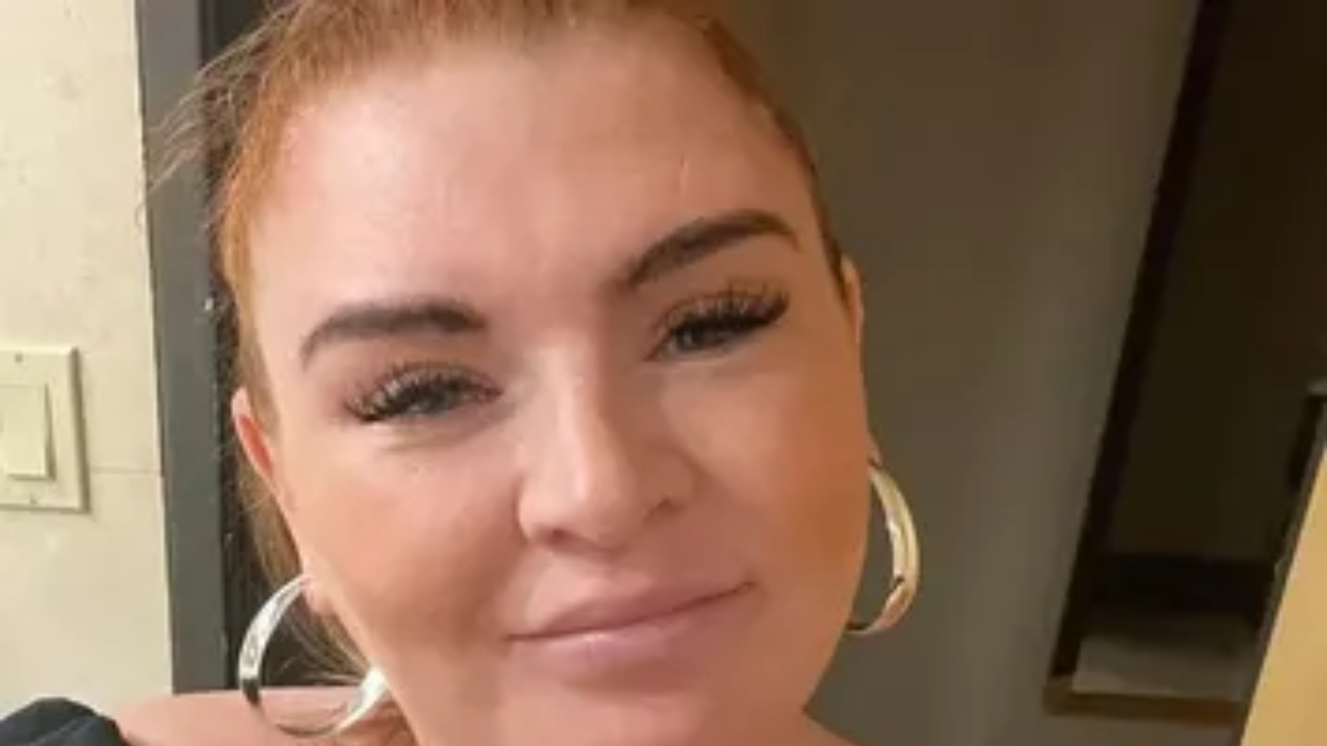 Mujer Muere en Cirugía de Manga Gástrica para Bajar de Peso | N+