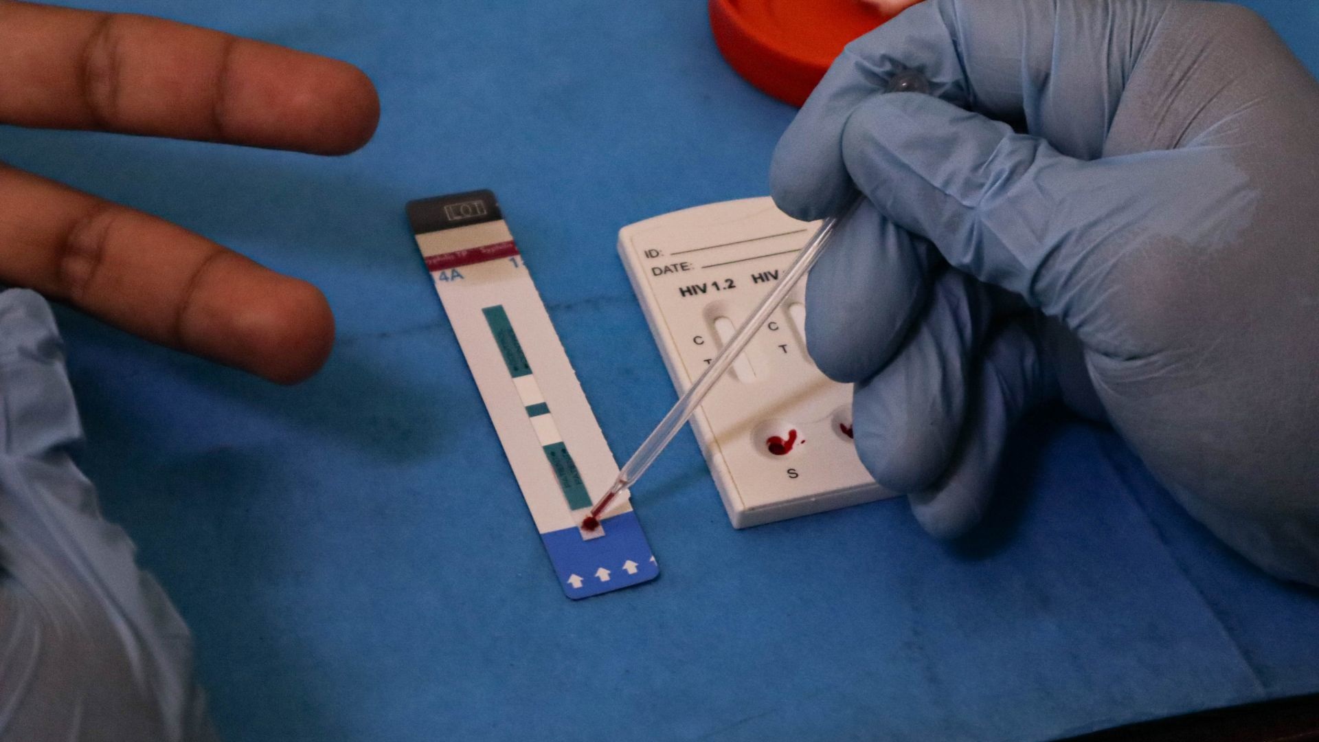 Paciente de Ginebra, Primera Persona Curada de VIH por Trasplante de ...