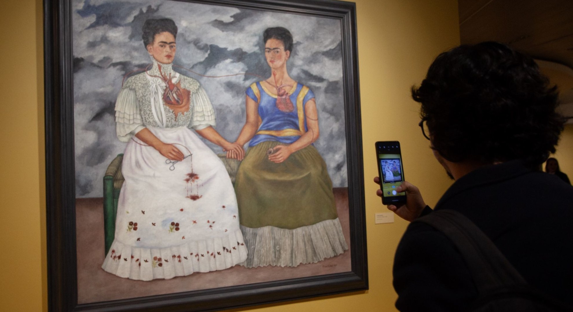 Frida Kahlo Padecía Síndrome de Cola de Caballo, Revela Estudio | N+