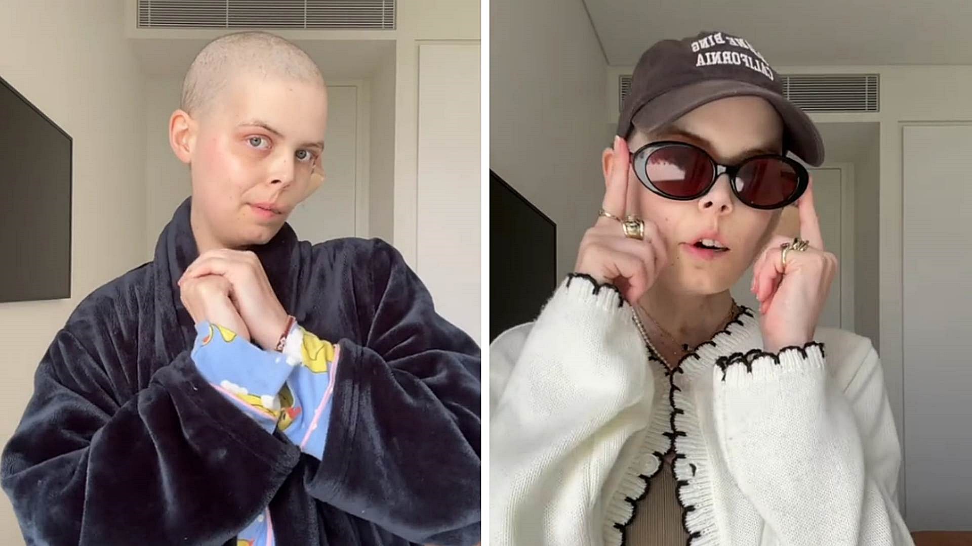 Bella Bradford: Muere Influencer de 24 Años Por Cáncer Terminal; Se ...