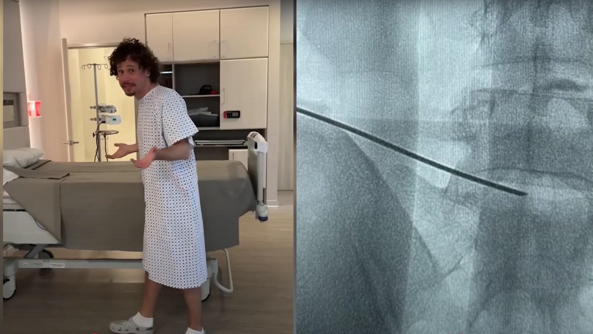 ¿Operaron a Luisito Comunica? 'Luisillo El Pillo' Dice Qué Pasó y el ...