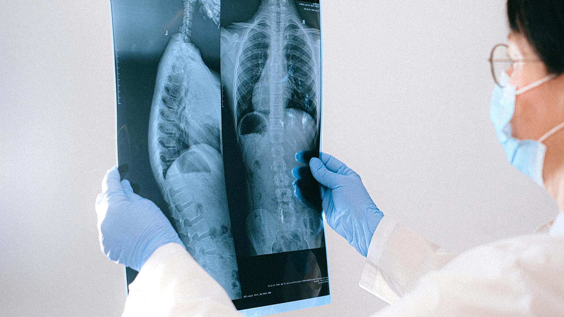 Neumonía Bilateral: Qué es y Cuáles Son los Síntomas de la Enfermedad que Tiene el Papa ...