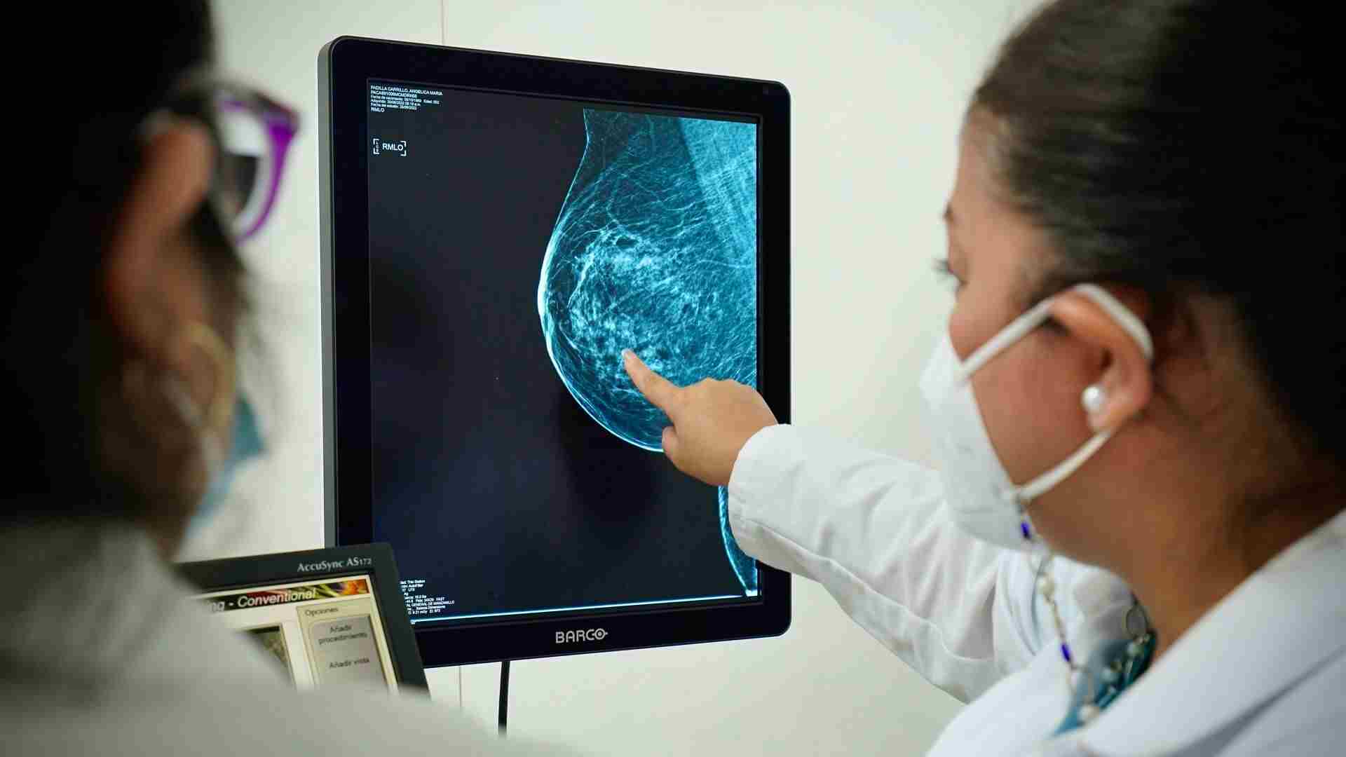 Lucha contra el Cáncer de Mama: Importancia de la Autoexploración y ...