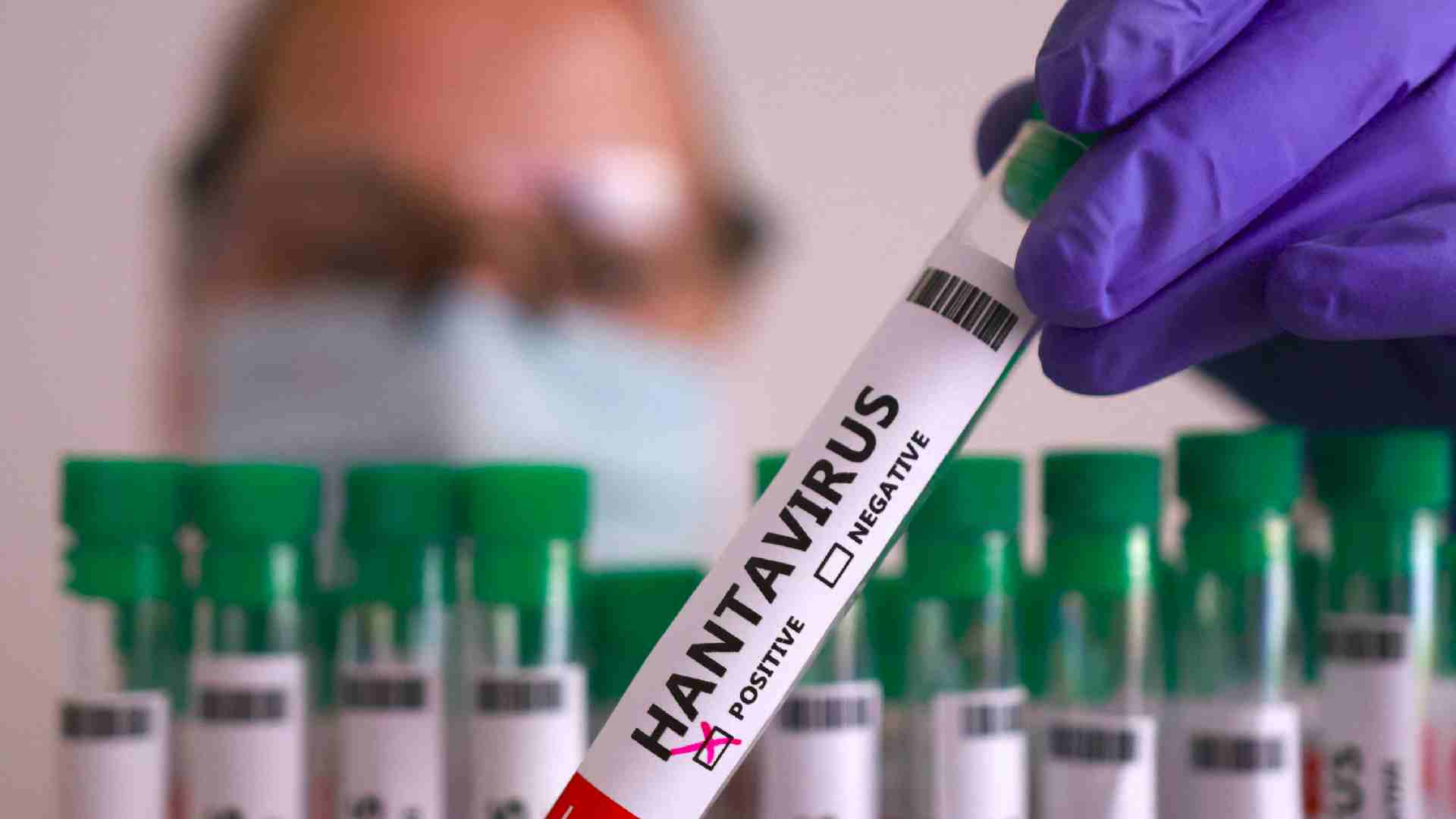 Moderna Hará Vacuna Contra El Hantavirus Empresa Anuncia Desarrollo De