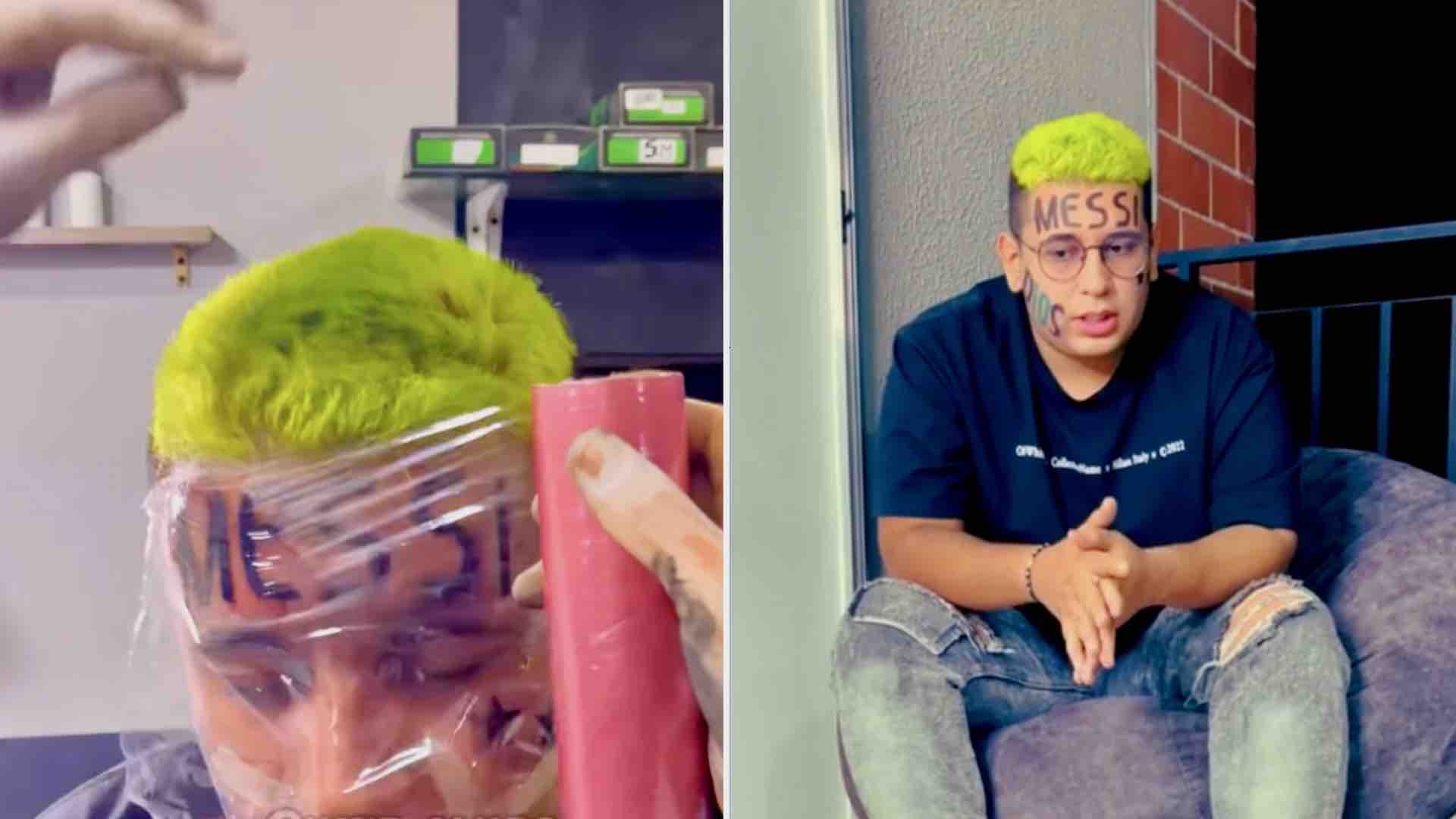 Joven con tatuaje de Messi en la cara se arrepiente | N+