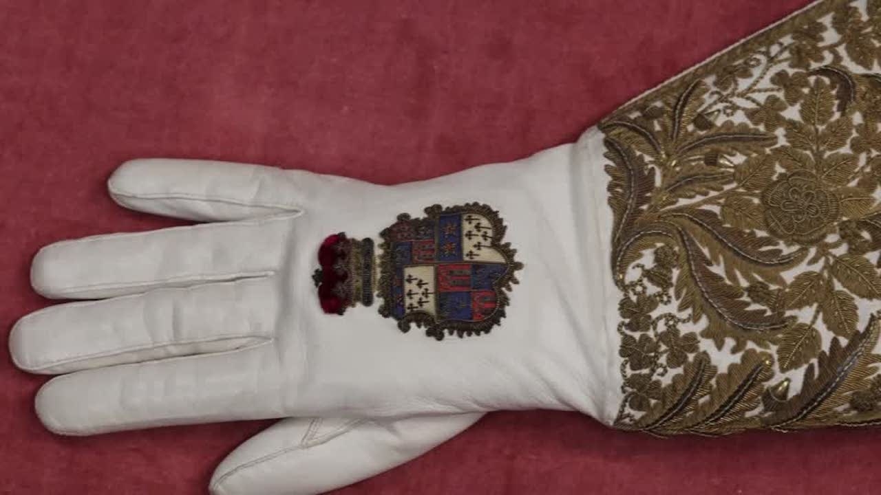 Enfermedad del Rey Carlos III: ¿Qué es la Dactilitis y Por Qué Causa ...