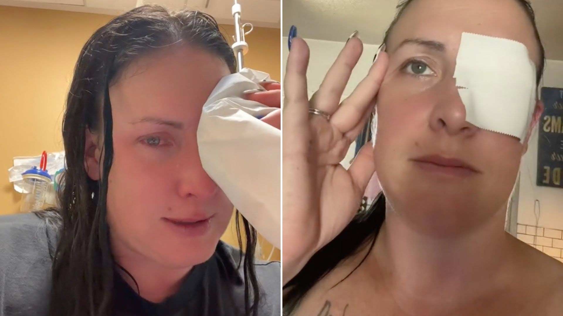 Mujer Confunde Gotas para Ojos con Pegamento, Se lo Aplica y Se Pega un ...