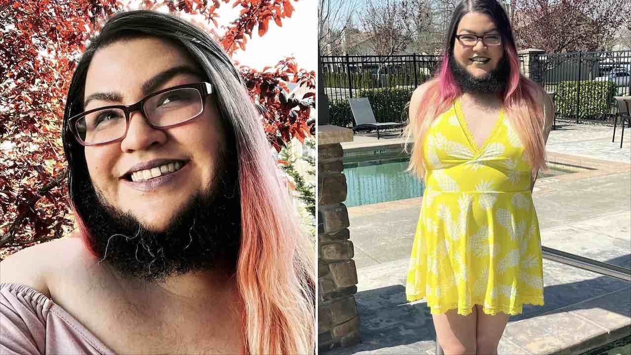 Mujer Se Deja Crecer la Barba y Dice que ahora Es ‘Genuinamente Hermosa ...