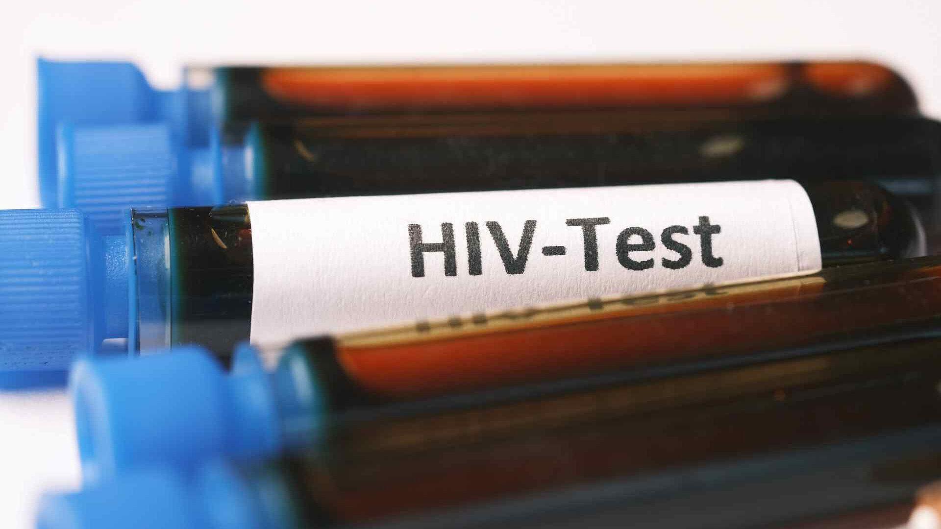 Prueba en México: Avances en la Prevención del VIH con Método ...