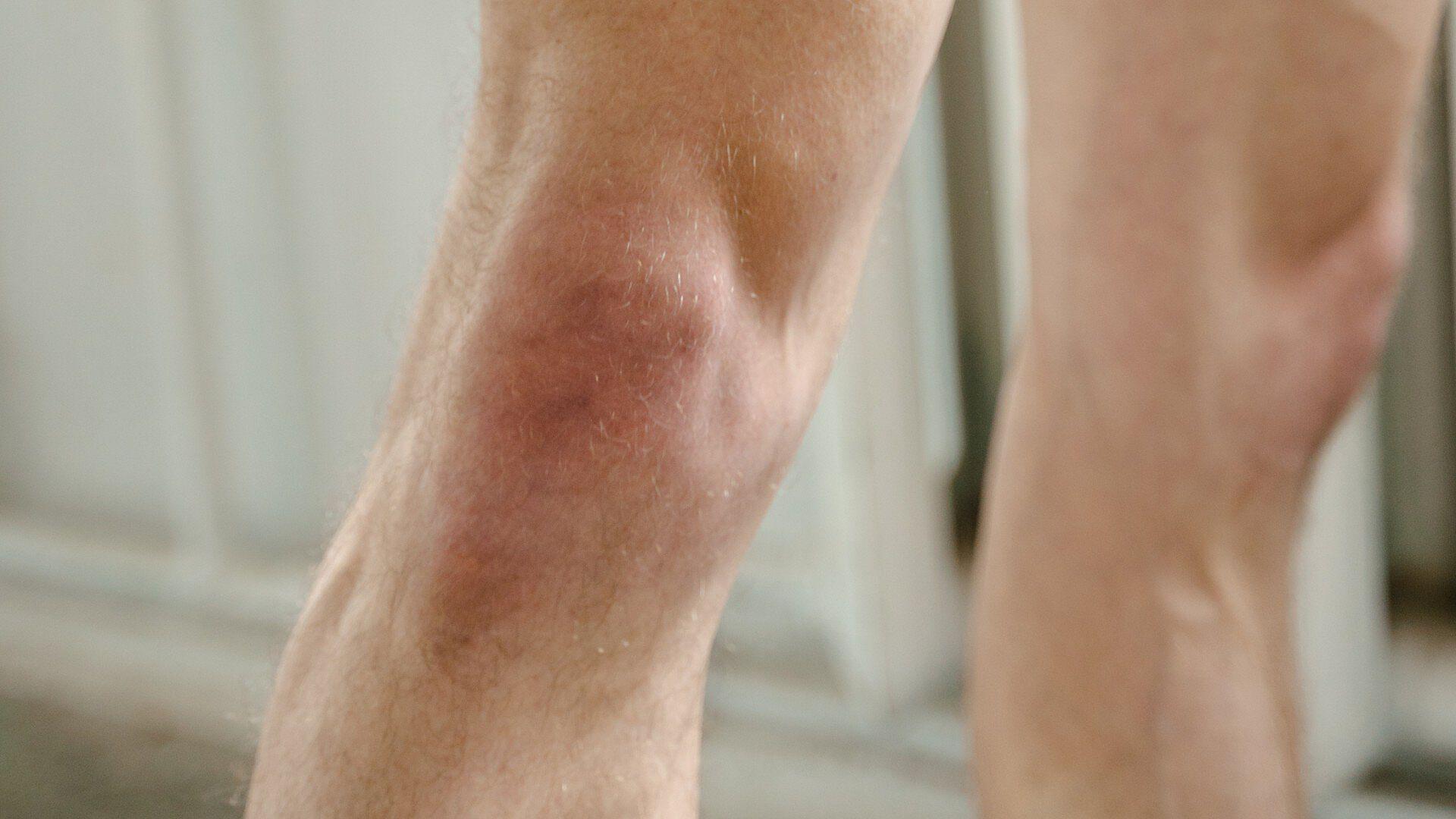 Rutina de Ejercicio para la Rodilla | N+