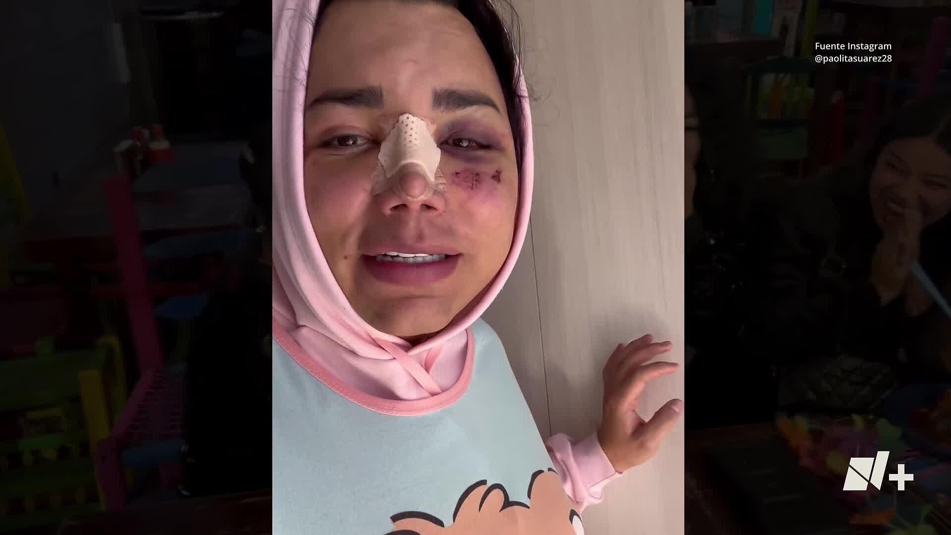 Dan de Alta del Hospital a Paola Suárez Después de la Golpiza que le ...