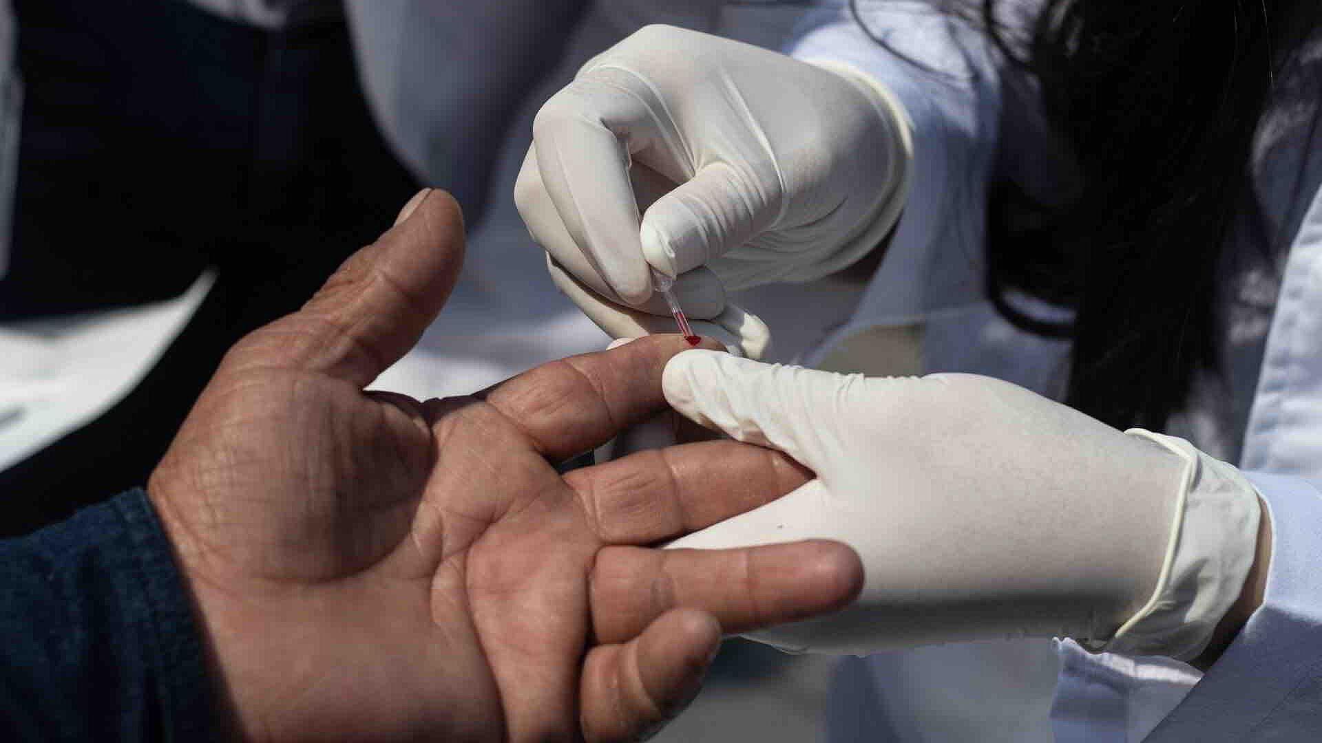 Realizan Pruebas de Hepatitis C y VIH en Módulo de IMSS, en el Marco de ...