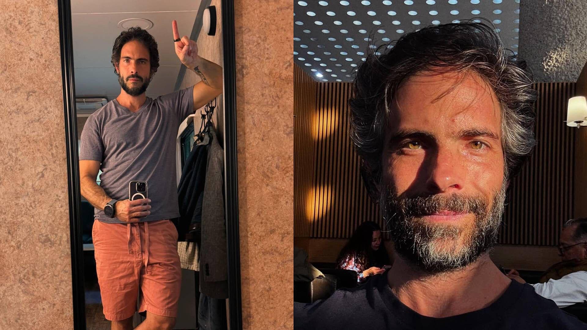 Osvaldo Benavides Aparece en Redes Sociales con el Rostro Deformado ¿Qué le Sucedió? | N+