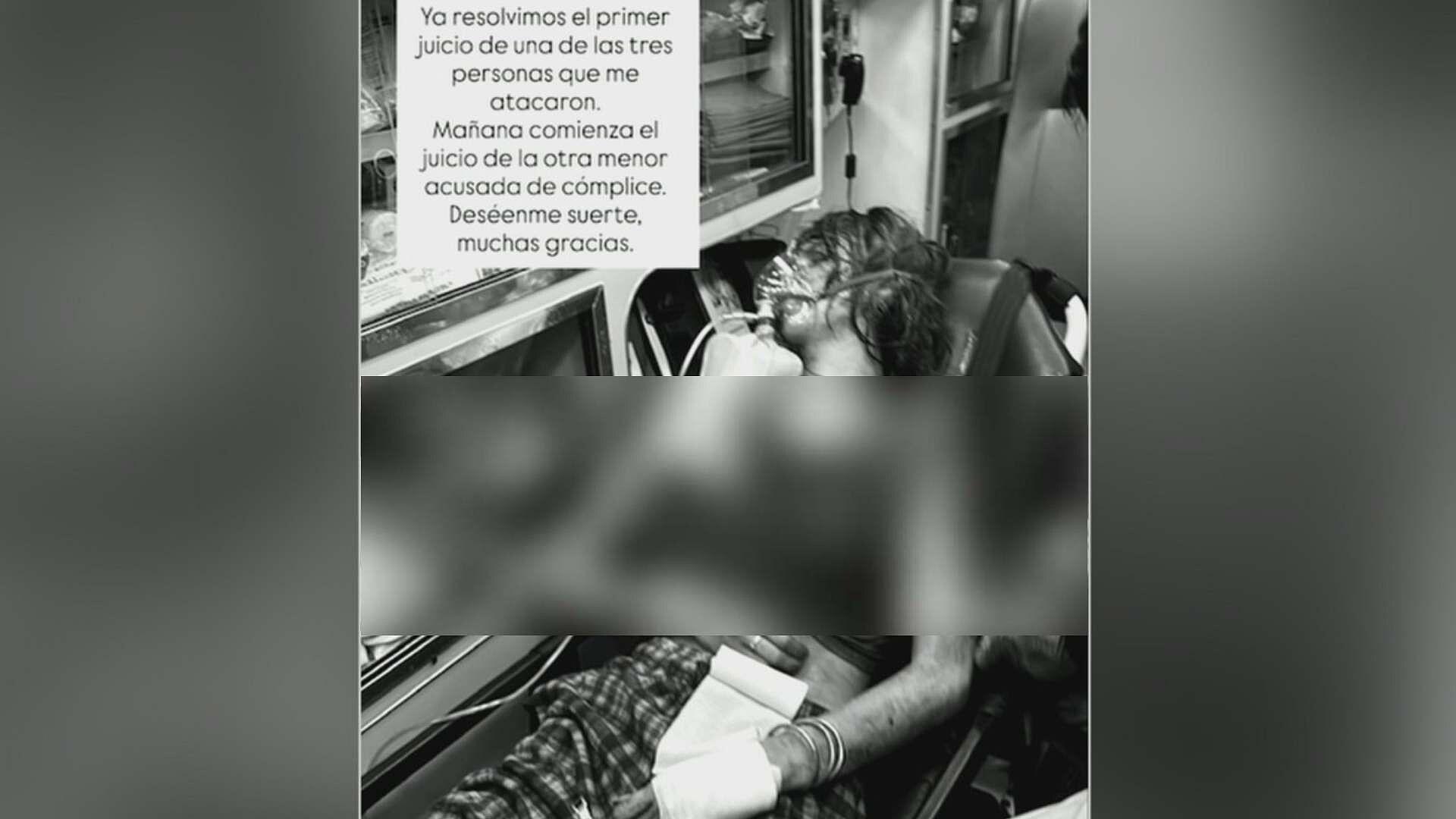 Valentina Gilabert Revela Foto de Momentos Después de que Fue Apuñalada ...